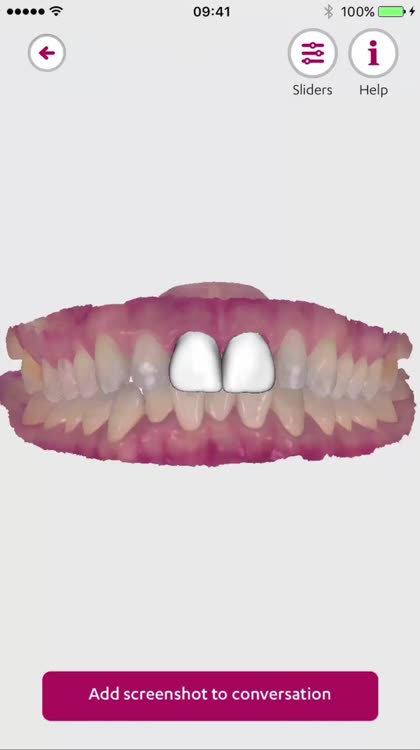 3Shape Communicate by 3Shape